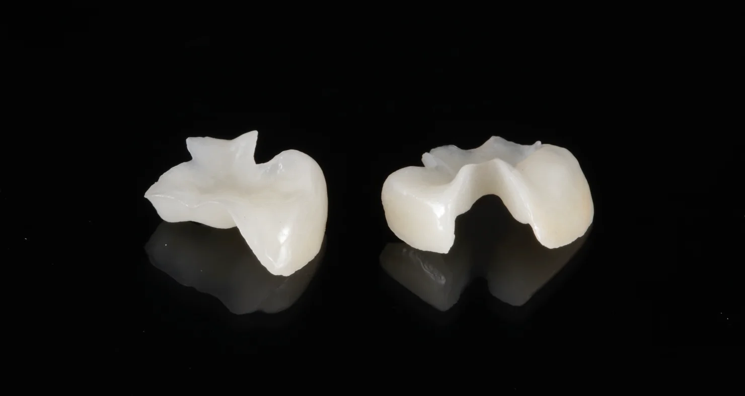 Saving natural smiles, one tooth at a time. - viosdental.com